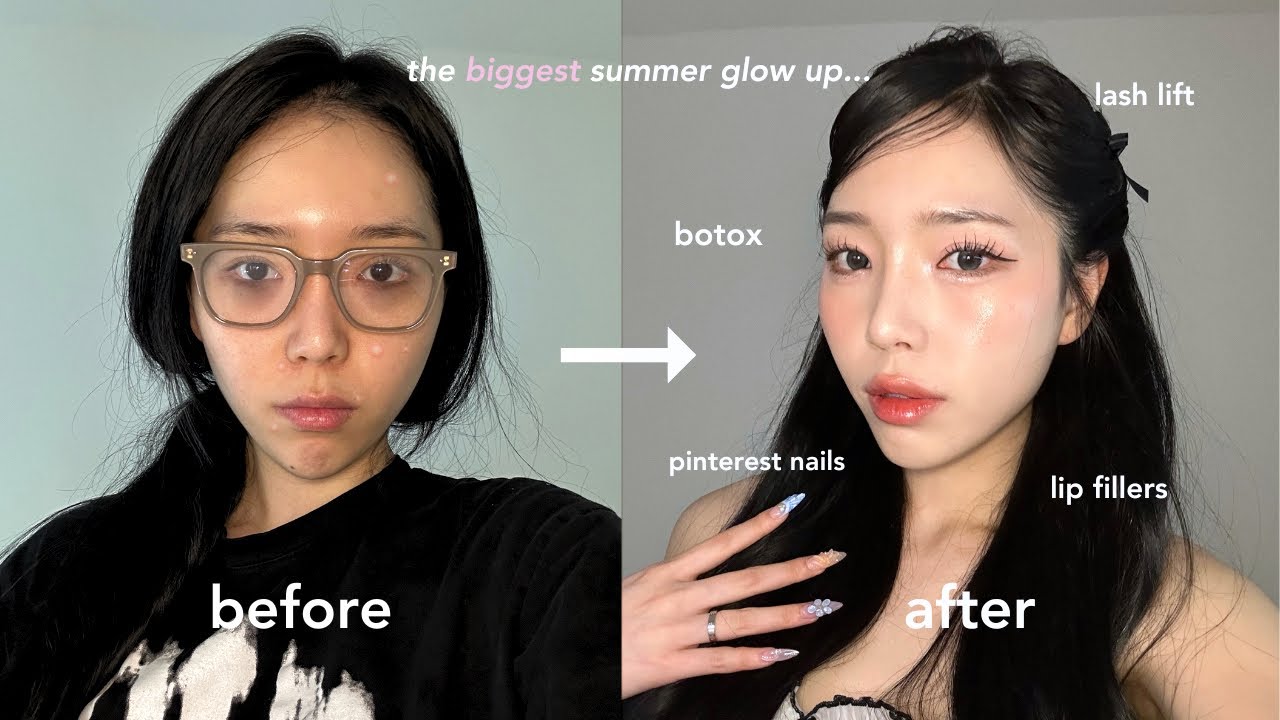 $3000 extreme summer glow up in nyc (fillers, botox, nails, lashes, etc ...