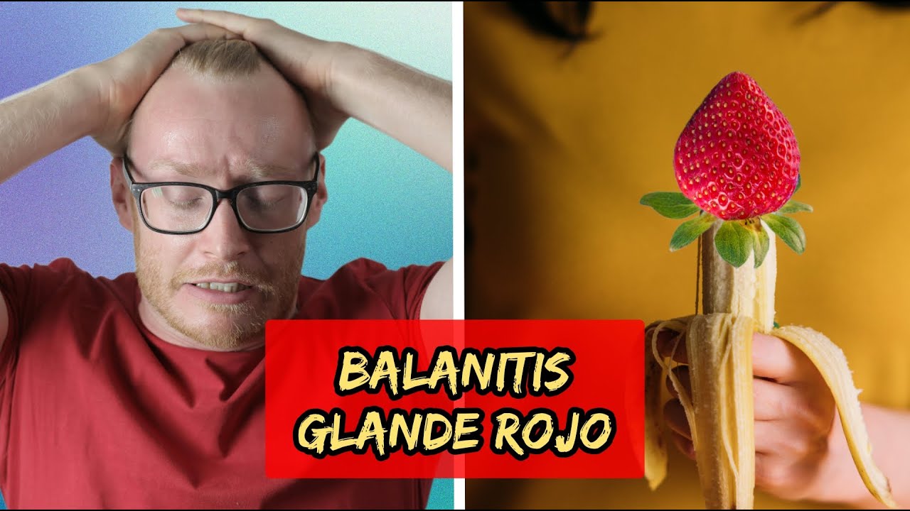 Balanitis – Postitis - YouTube