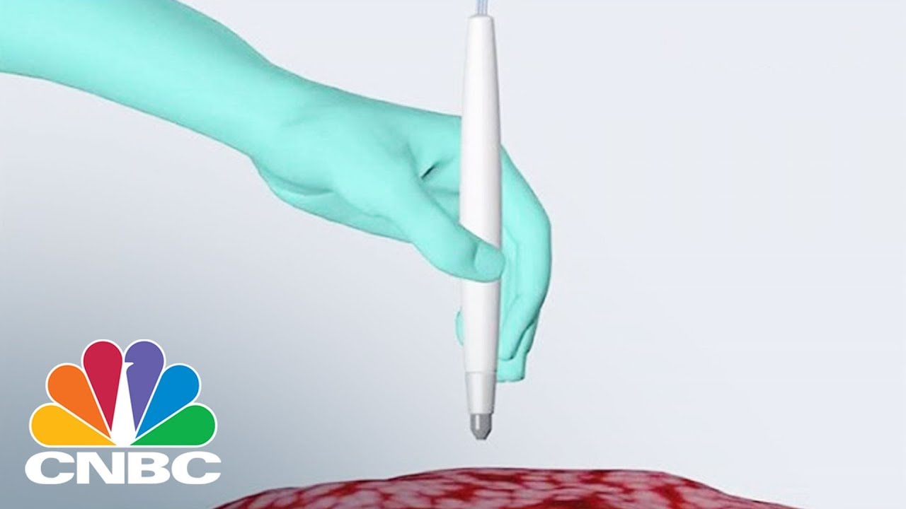 Scientists Say They Invented A Cancer-Detecting Pen | CNBC - YouTube