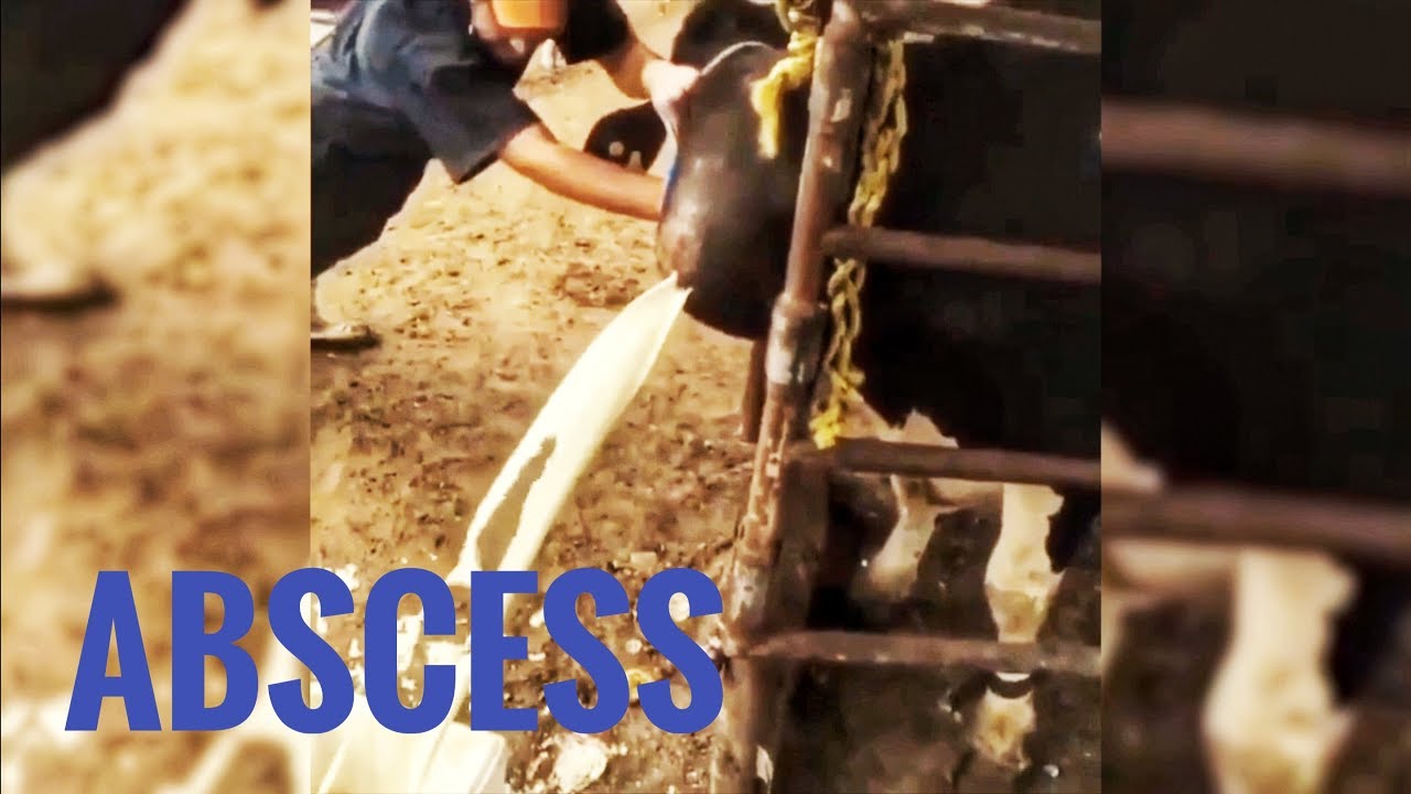 BEST ABSCESS COMPILATION - YouTube