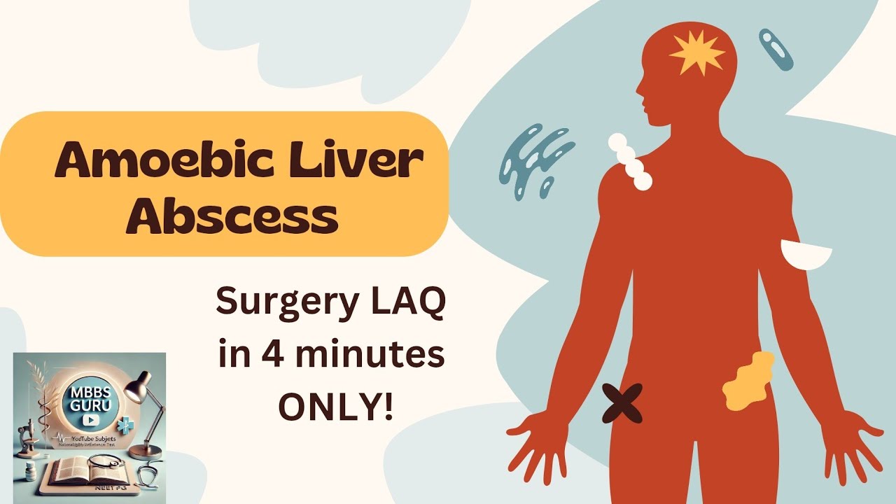 Amoebic Liver Abscess in 4 minutes ONLY (Surgery LAQ) - YouTube