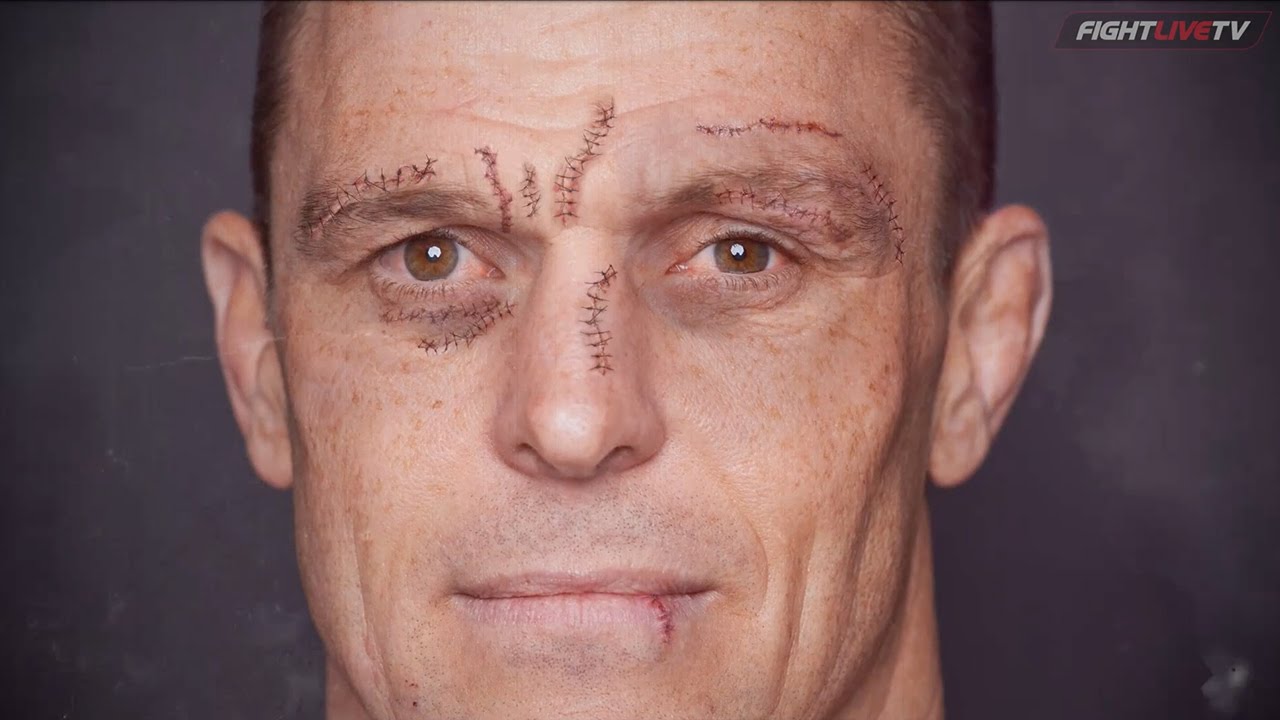 Parr's Scars - YouTube