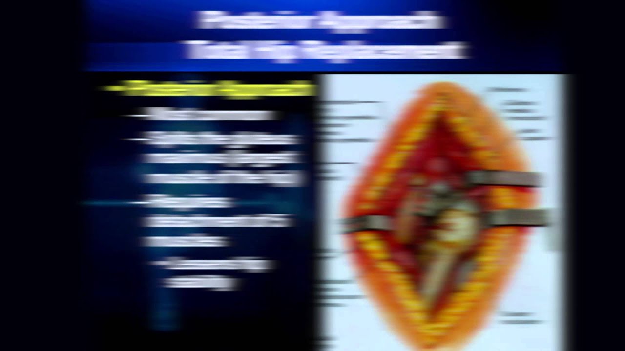 Posterior and Anterolateral Hip Replacement - YouTube