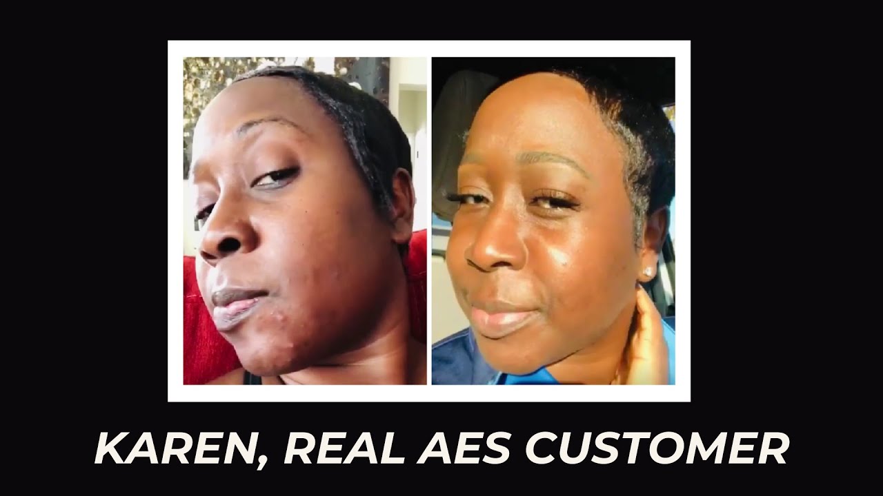KAREN, REAL AES CUSTOMER - YouTube