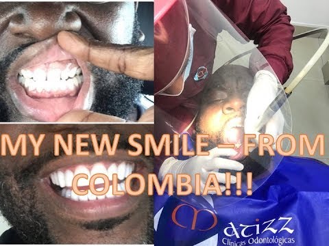 My New Teeth...from COLOMBIA! Hear all about my SMILE MAKEOVER. - YouTube