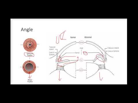 HY Ophthalmology - Red Eye (Inflammations & Infections) for AMC 1 MCQ