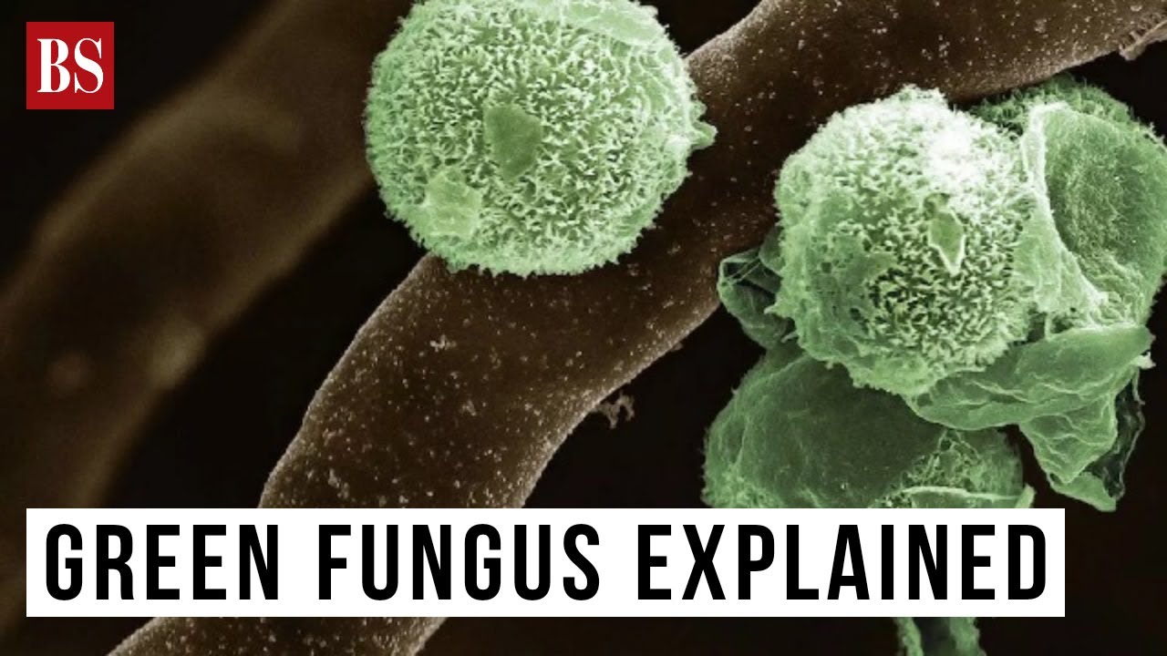 Green Fungus explained: Causes, symptoms and everything we know so far ...