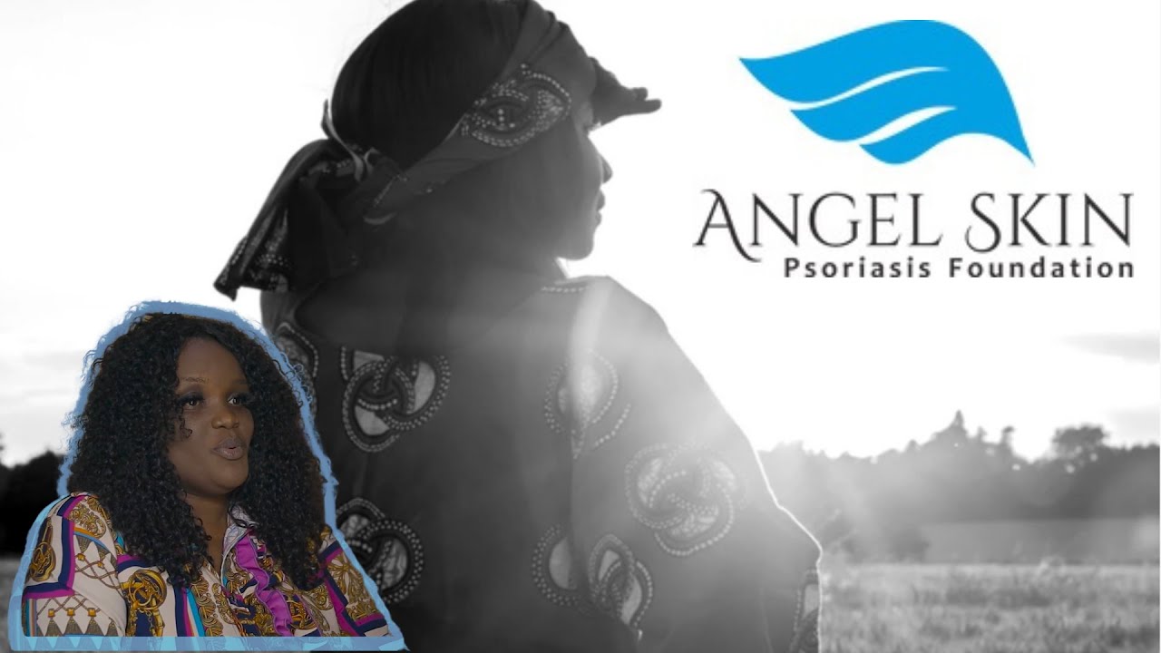 Living With Psoriasis - An Angel Skin Foundation Documentary with ...