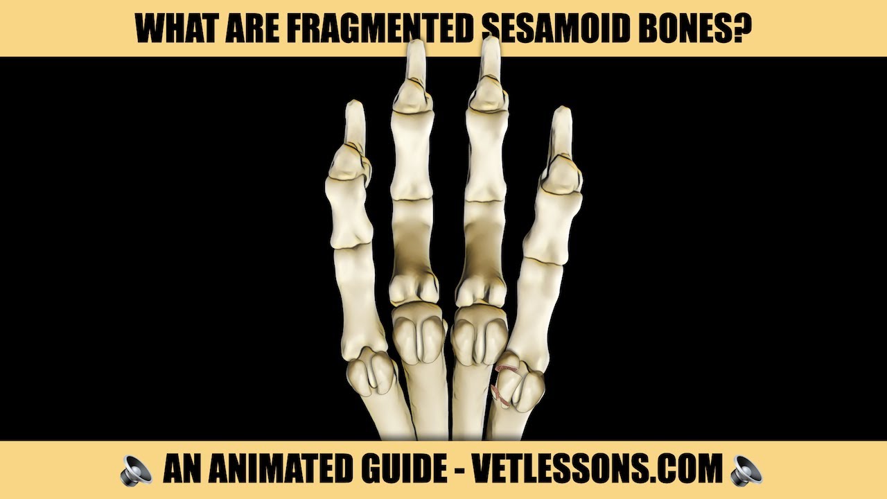 WHAT ARE FRAGMENTED SESAMOID BONES? - YouTube