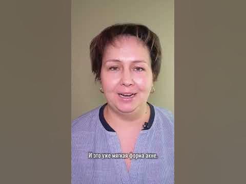 Черные точки или сальные нити - YouTube
