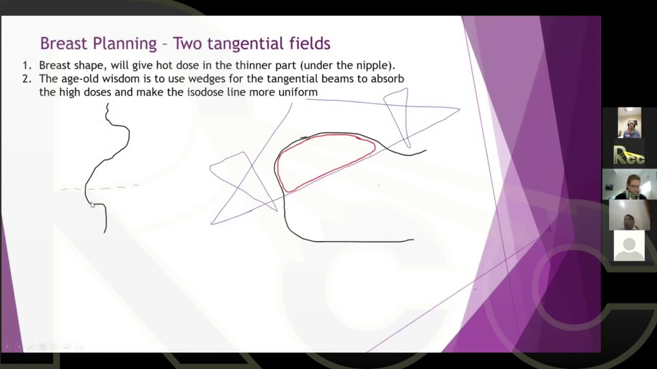 2D to 3D EBRT | Session 7 | Advanced 3D Planning Methods - YouTube