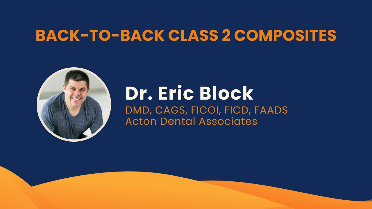 Blocky Tips 01 - Back-to-back Class 2 Composites - YouTube