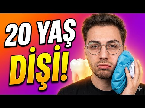 20 YAŞ DİŞİ İLE İLGİLİ MERAK EDİLENLER | ÇEKTİRECEKLERE TAVSİYELER (Tecrübelerim)