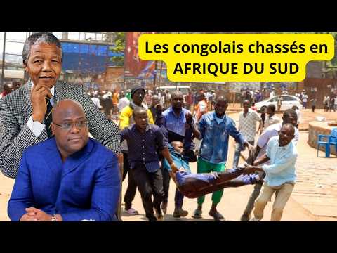 LES CONGOLAIS CHASSES DE L H'OPITAL EN AFRIQUE DU SUD