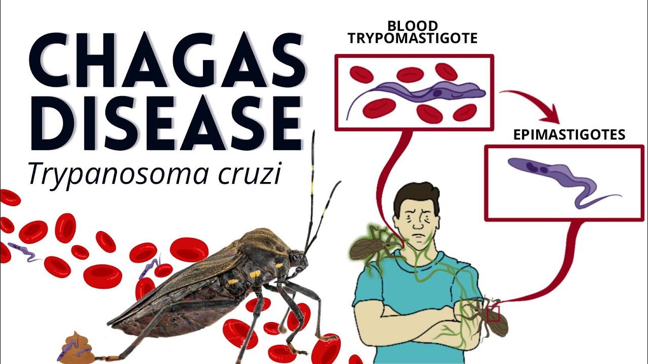 Don't Let the Kissing Bug Bite! Understanding Chagas Disease ...