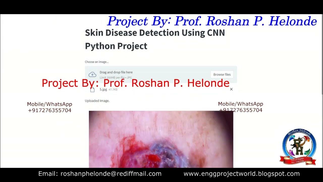 Skin Disease Detection Python Code | Skin Disease Detection Using CNN ...