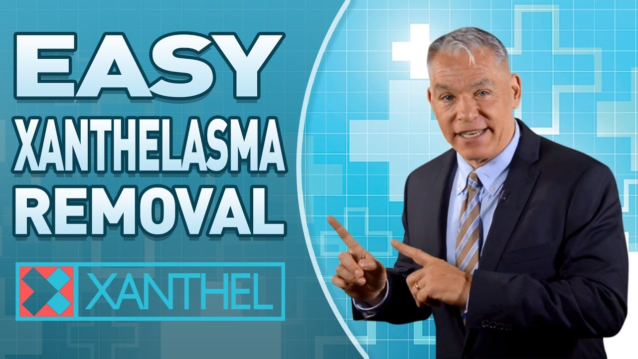 Xanthelasma Removal Made Easy With Xanthel ® - YouTube