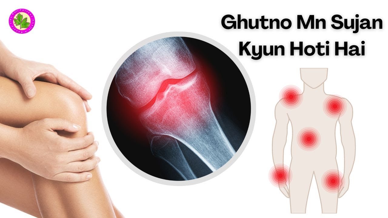 Ghutno me Sujan | Knee Joint Pain - YouTube