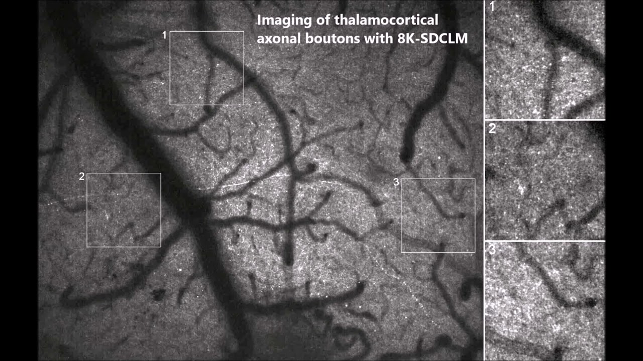In vivo wide-field calcium imaging of mouse thalamocortical synapses ...