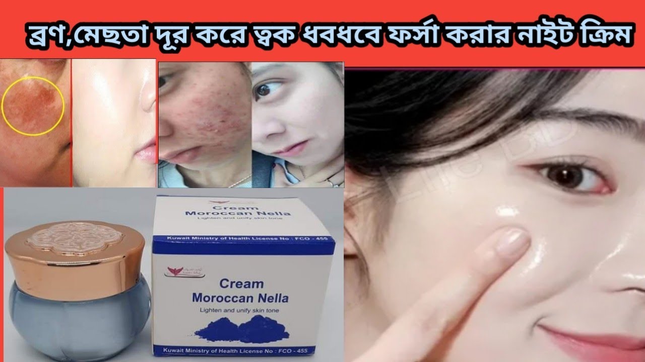 ৭ দি‌নে ব্রণ ও মেছতা,কা‌লো দাগ দূর কর‌ে ত্বক ধবধব‌ে ফর্সা কর‌বে ...