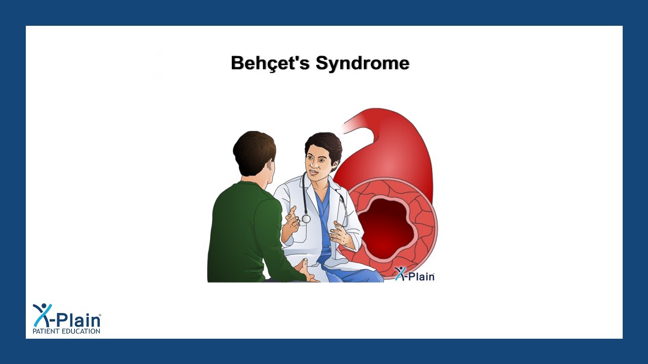 Behcet's Syndrome - YouTube