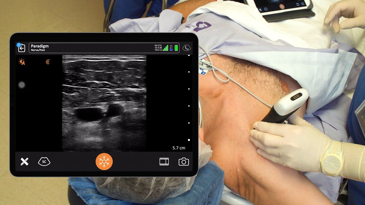 Pre-Op Infraclavicular Block - YouTube