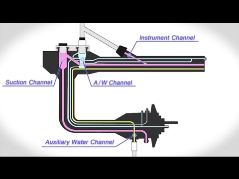 OER-Pro Uses Connector Overflow System - YouTube