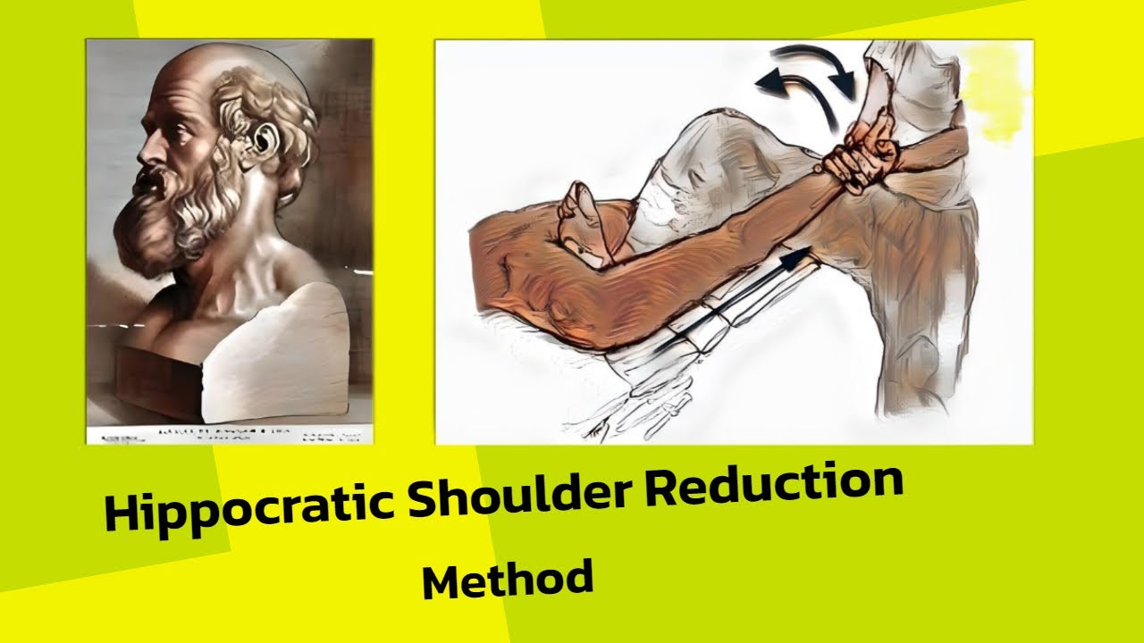 This Ancient Shoulder Reduction Technique Works! - YouTube