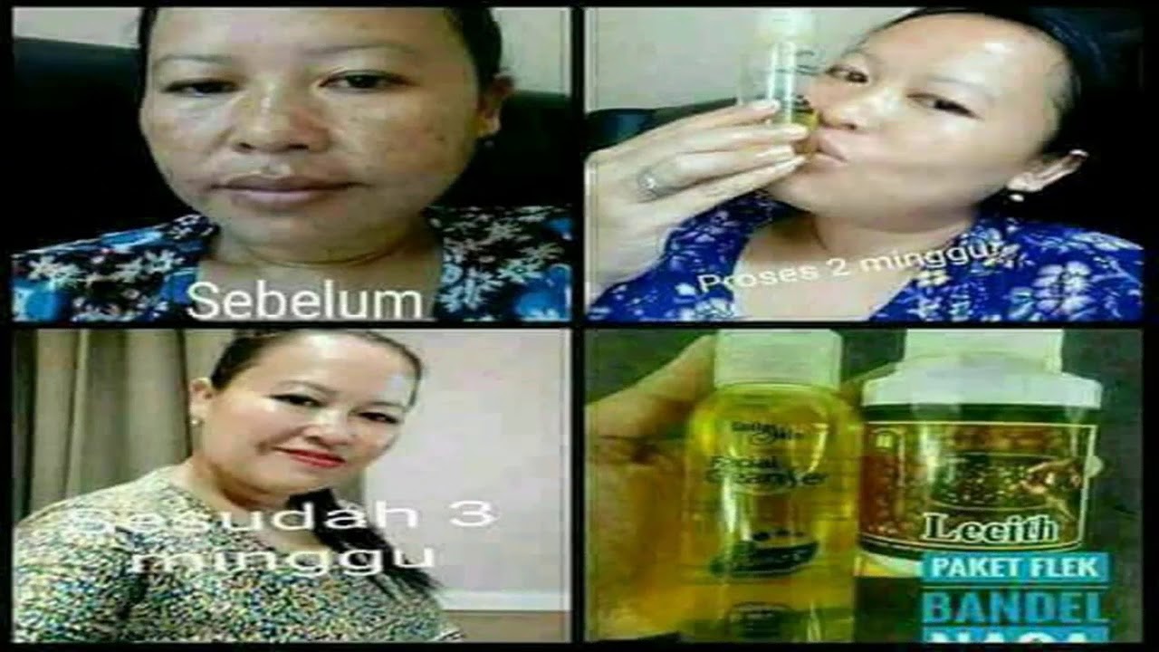 0852 3367 4981 Paket Flek Hitam diwajah Nasa di Surabaya - YouTube