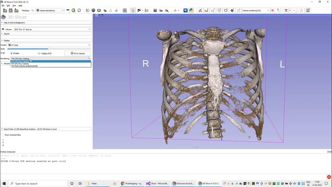 How to enable GPU volume rendering in 3D Slicer - YouTube
