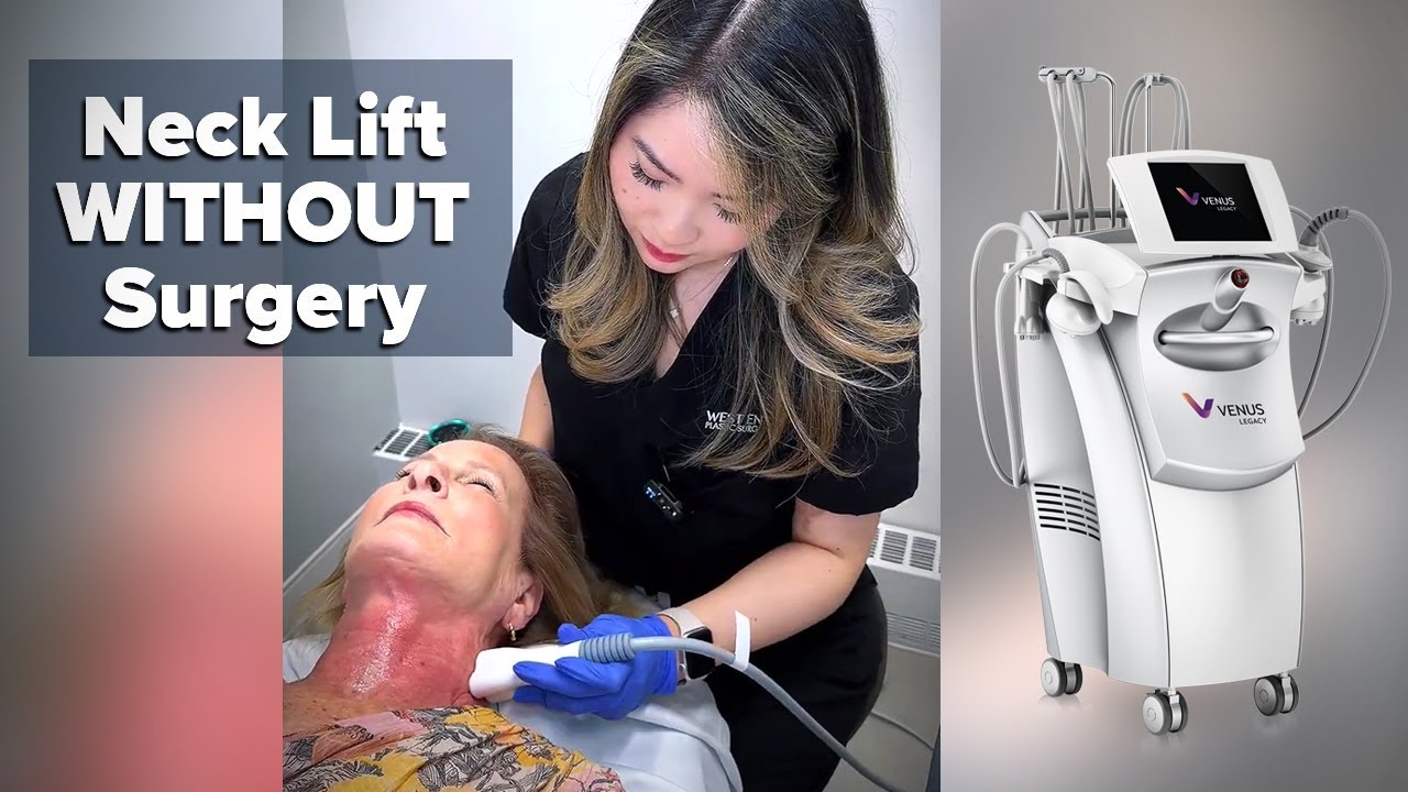 Tighten & Lift Your Neck Without Surgery - Introducing Venus Legacy RF ...