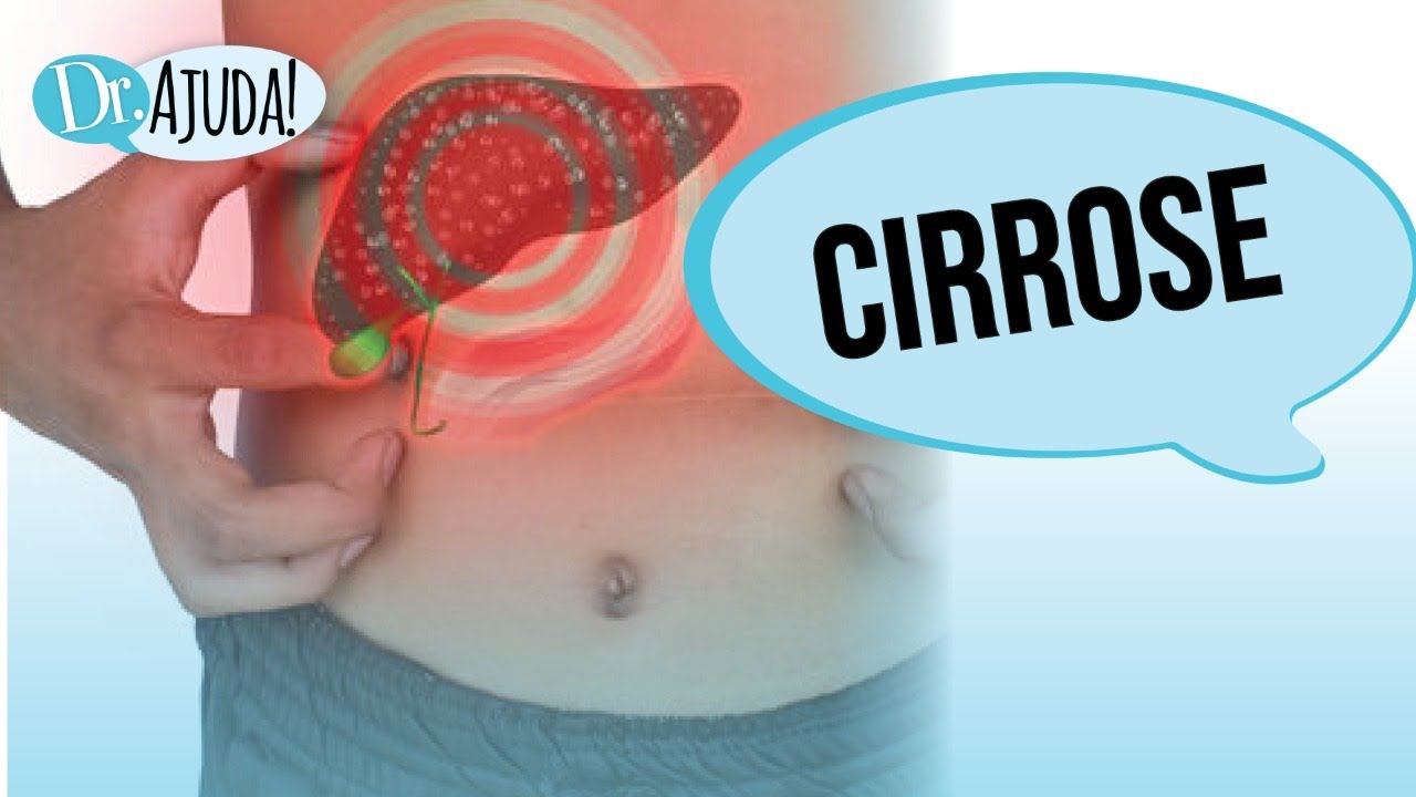 VOCÊ SABE O QUE É CIRROSE HEPÁTICA? - YouTube