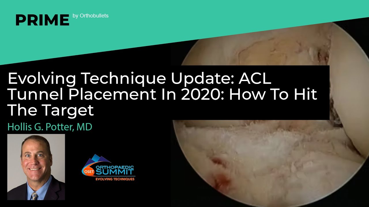 Evolving Technique Update: ACL Tunnel Placement In 2020: How To Hit The ...