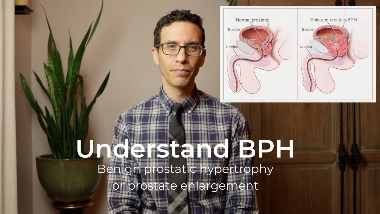 Urologist explains the basics of BPH | prostate enlargement | benign ...
