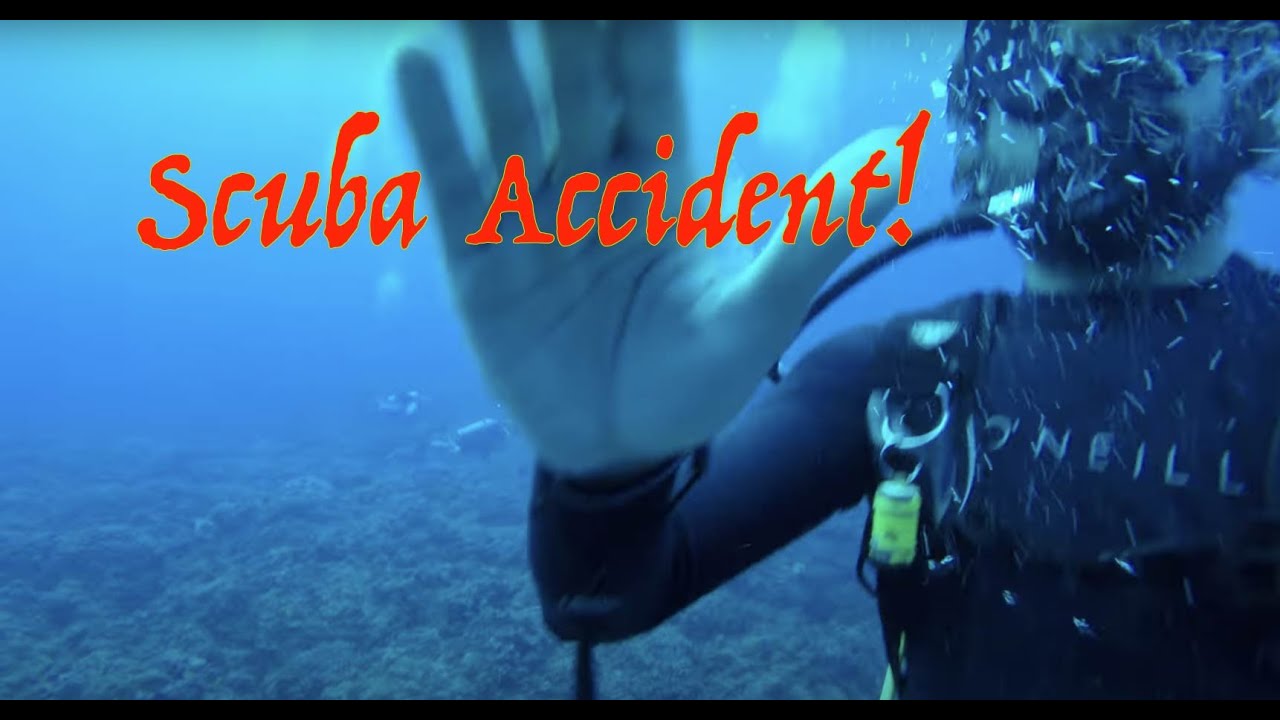 My scuba accident - passed out! Needed CPR. - YouTube