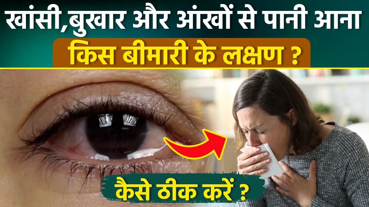 Fever Cough Watery Eyes Treatment: सर्दी,खांसी,बुखार,आंखों से पानी आने ...