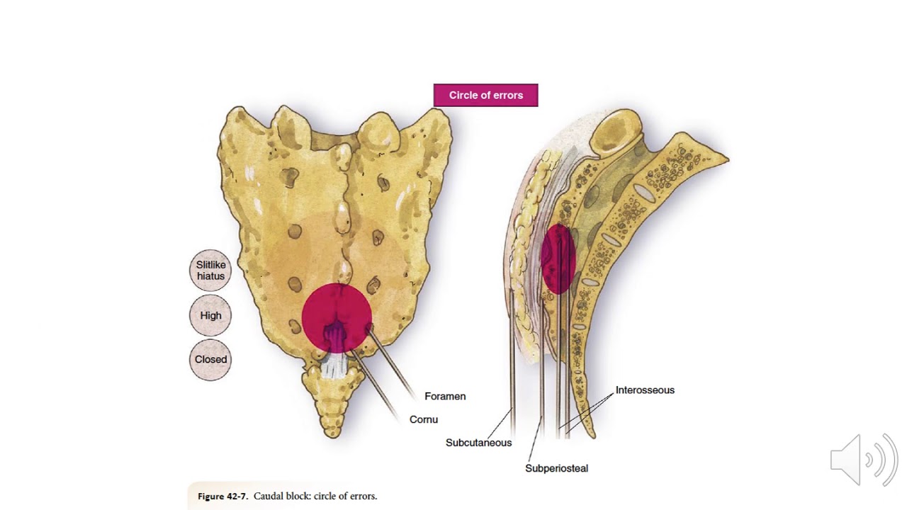 Keyword Review: Generic Clinical Anatomy (Part 1) - (Dr. Bowe) - YouTube