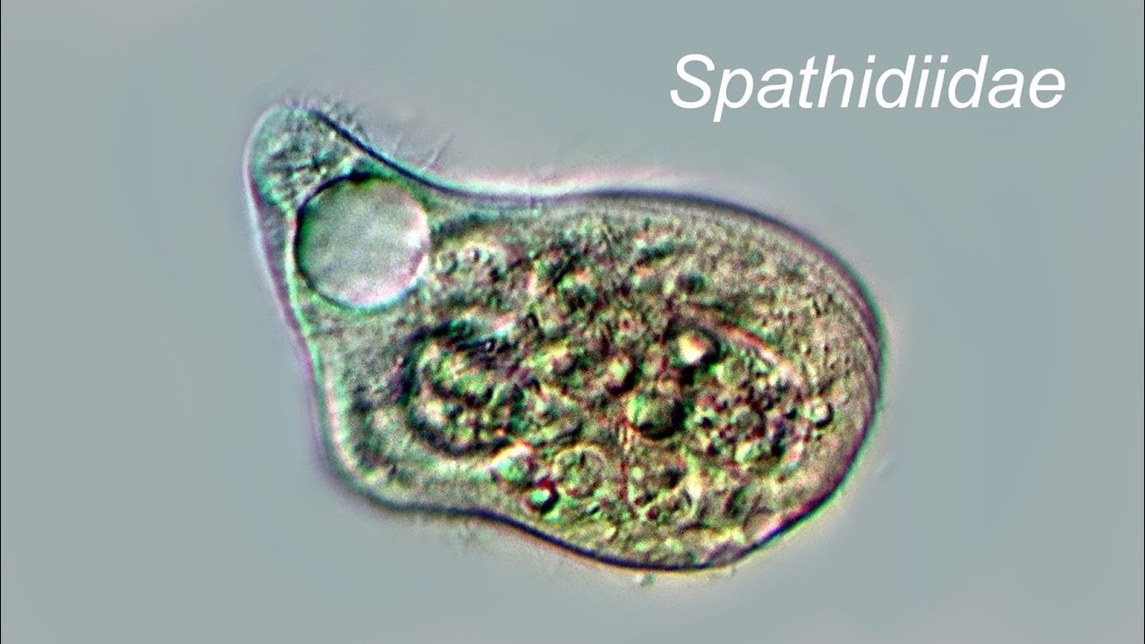 Spathidium seppelti ? - YouTube