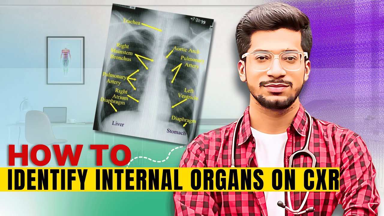 Identification Of Internal Organs On Chest Xrays | Block 3 Osve - YouTube