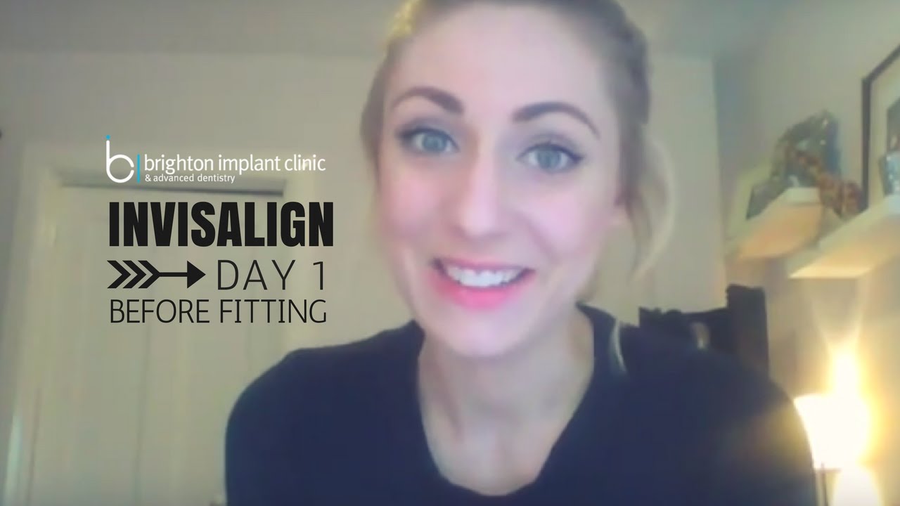 Invisalign Treatment Vlog Week 1 - YouTube