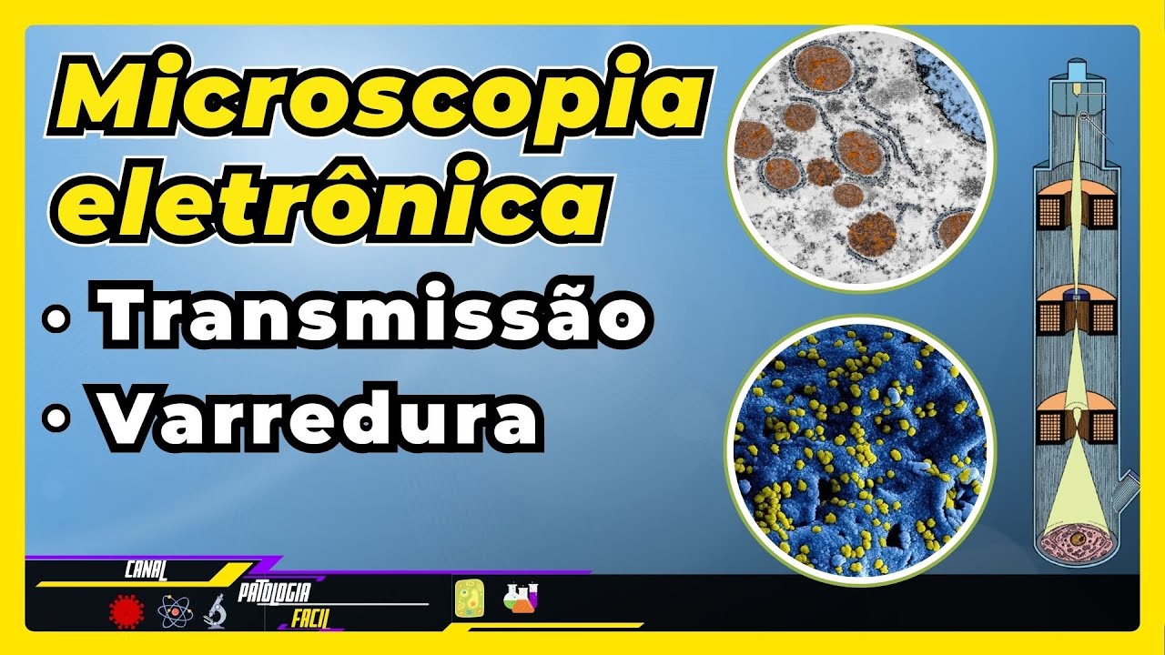 Microscopia Eletrônica: de Transmissão (MET) e de Varredura (MEV ...