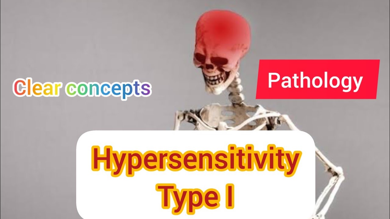 Hypersensitivity Reactions Type I HSR Pathology part II | Pathology ...