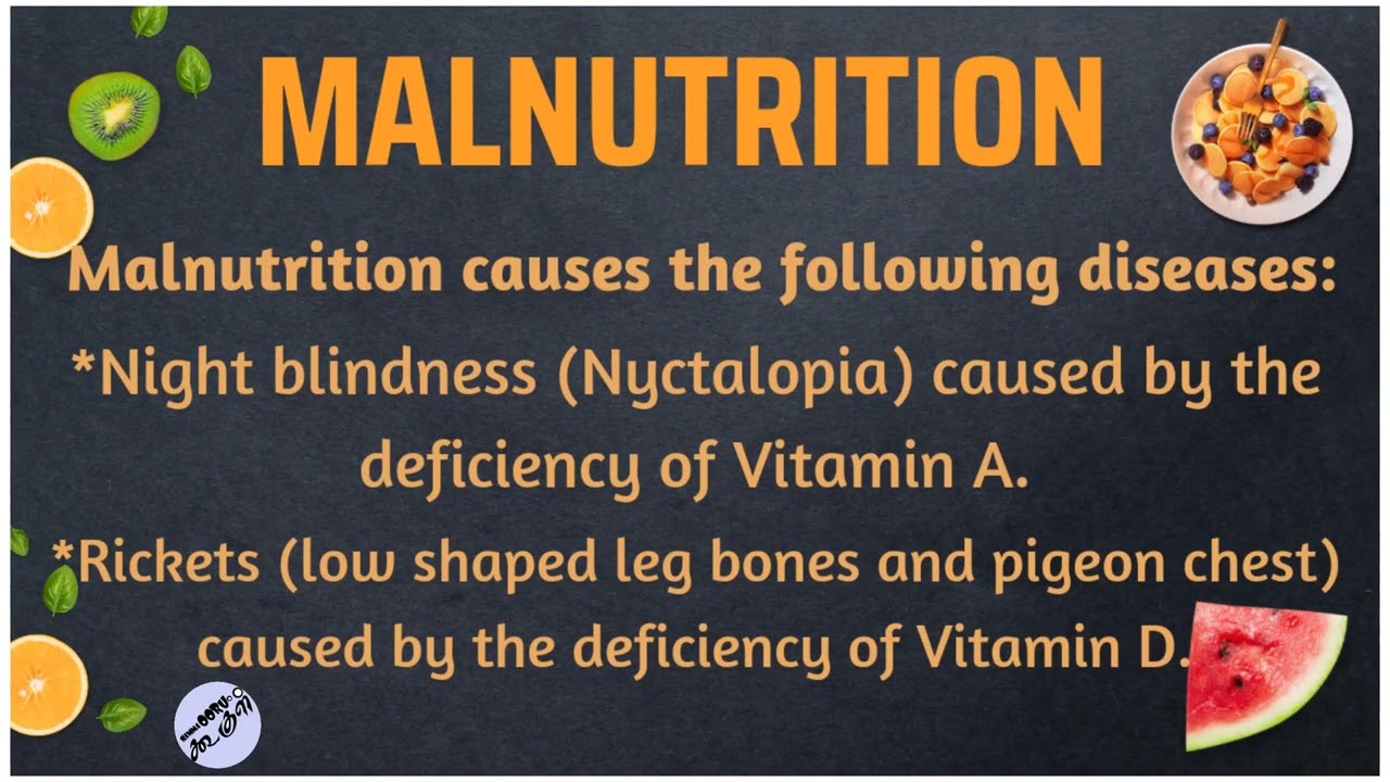 Malnutrition Biology In Tamil Nammaoorugoogle SET TNPSC YouTube Malnutrition Biology In Tamil Nammaoorugoogle SET TNPSC YouTube