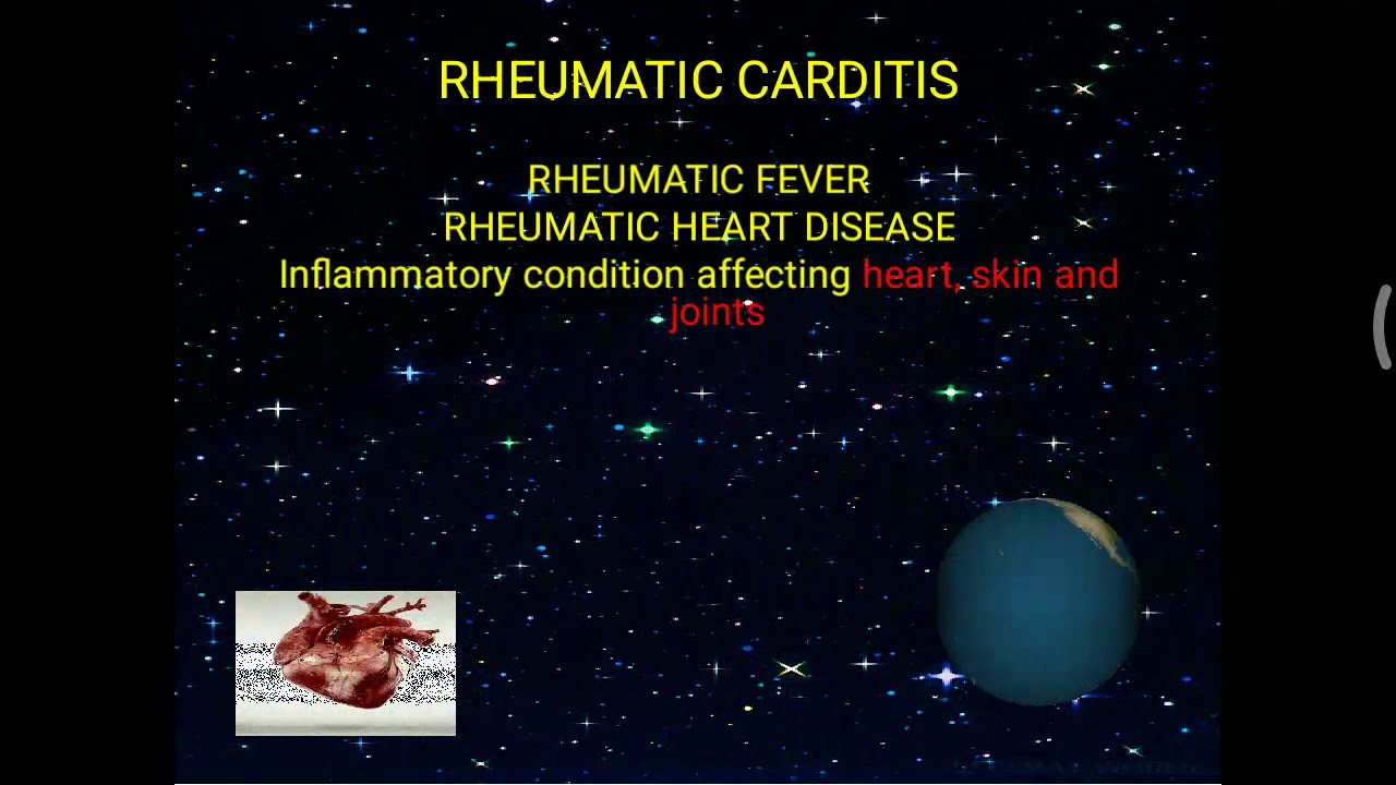 Rheumatic carditis - YouTube