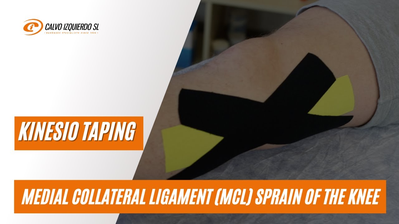 Kinesio Taping for Medial Collateral Ligament (MCL) Sprain of the Knee ...