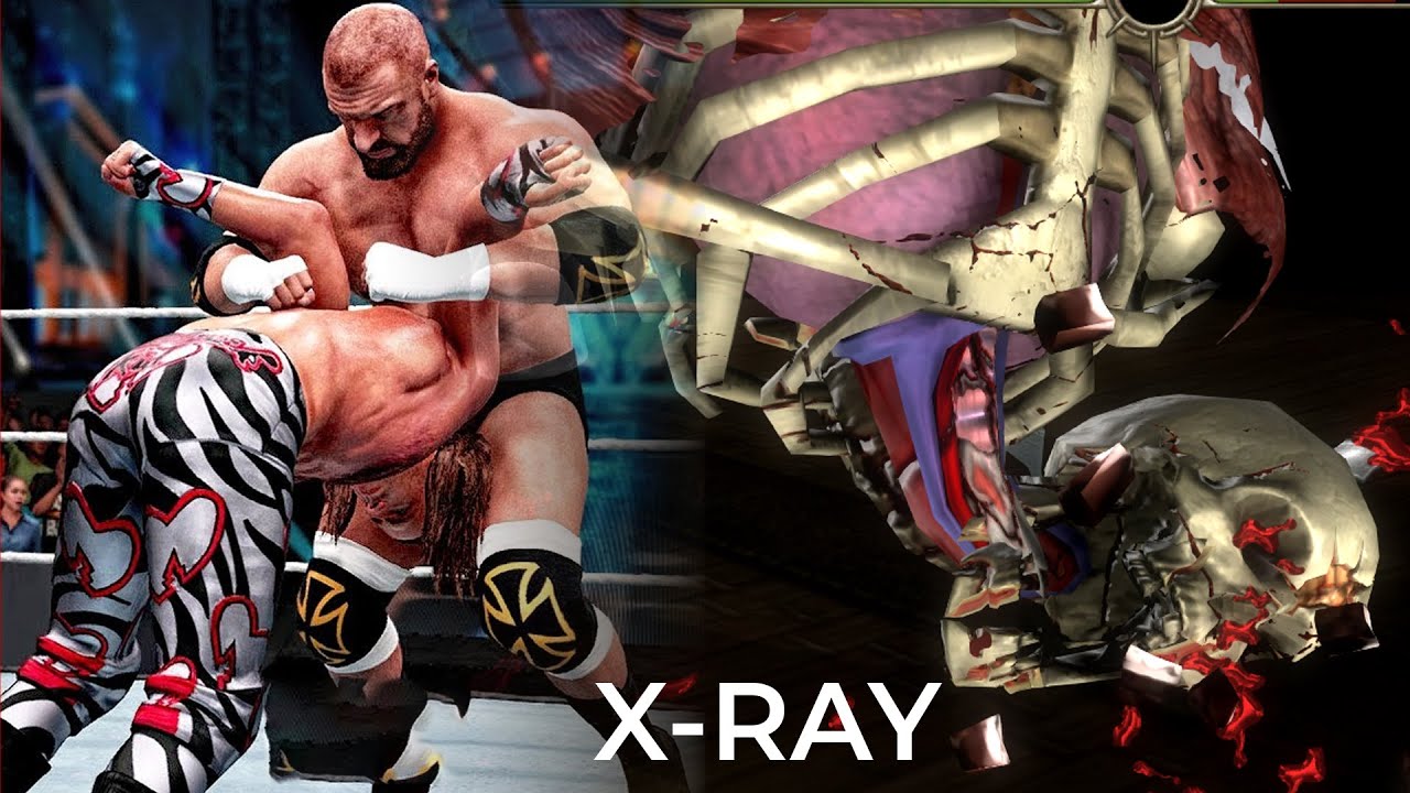 Bone-Breaking WWE SmackDown Moves Amplified by X-Ray Effects! - YouTube