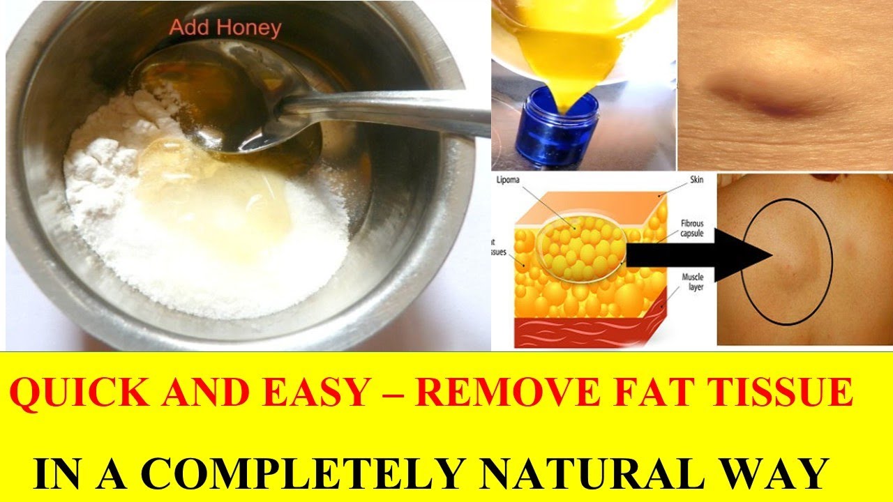 QUICK AND EASY – REMOVE FAT TISSUE IN A COMPLETELY NATURAL WAY - YouTube