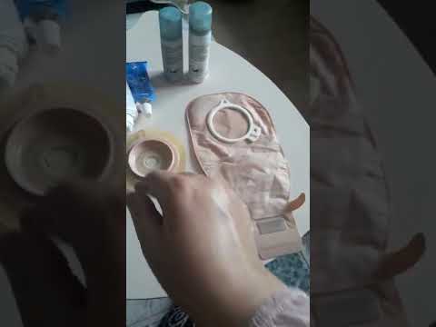kolostomi torbası değişimi ve bakımı#kansersizyasam #hastalık #turnip_live #youtube