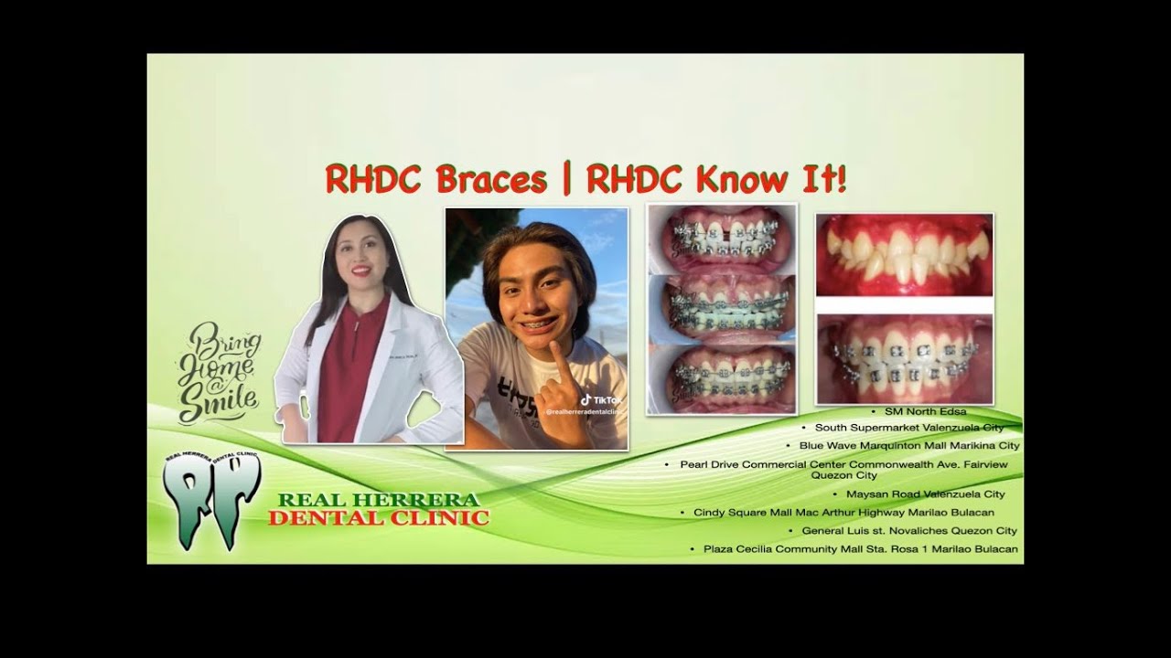 Braces | RHDC Know it - YouTube