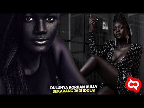 Bukti Cantik Gak Harus Putih.!! Super Model dengan Keunikan Warna Kulit yg Sukses Gebrak Dunia Mode
